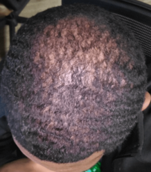 REVIAN RED Hair Growth System | Just the Right Light