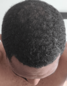 REVIAN RED Hair Growth System | Just the Right Light