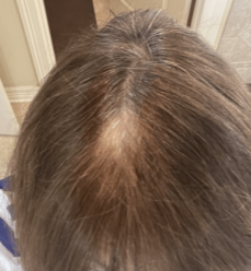 REVIAN RED Hair Growth System | Just the Right Light