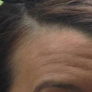 REVIAN RED Hair Growth System | Just the Right Light