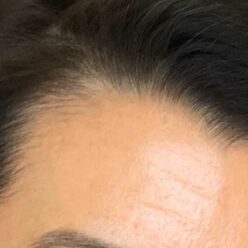 REVIAN RED Hair Growth System | Just the Right Light