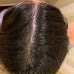 REVIAN RED Hair Growth System | Just the Right Light