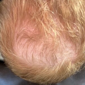 REVIAN RED Hair Growth System | Just the Right Light