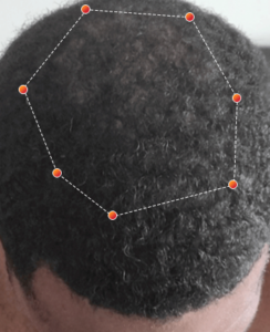 REVIAN RED Hair Growth System | The Right Light for Hair Growth