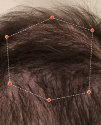 REVIAN RED Hair Growth System | The Right Light for Hair Growth