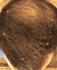 REVIAN RED Hair Growth System | The Right Light for Hair Growth