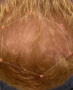 REVIAN RED Hair Growth System | The Right Light for Hair Growth