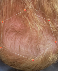 REVIAN RED Hair Growth System | The Right Light for Hair Growth