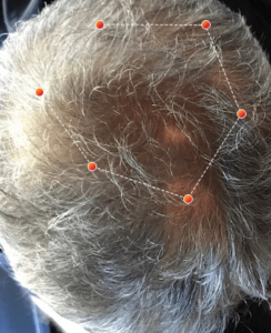 REVIAN RED Hair Growth System | The Right Light for Hair Growth