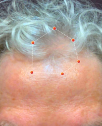 REVIAN RED Hair Growth System | The Right Light for Hair Growth