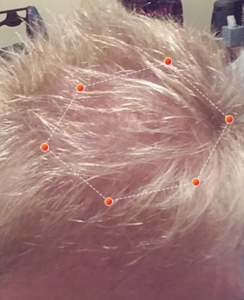 REVIAN RED Hair Growth System | The Right Light for Hair Growth