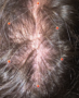 REVIAN RED Hair Growth System | The Right Light for Hair Growth