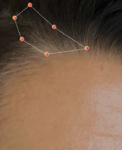 REVIAN RED Hair Growth System | The Right Light for Hair Growth