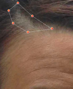 REVIAN RED Hair Growth System | The Right Light for Hair Growth