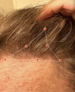 REVIAN RED Hair Growth System | The Right Light for Hair Growth