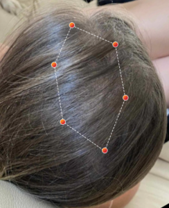 REVIAN RED Hair Growth System | The Right Light for Hair Growth