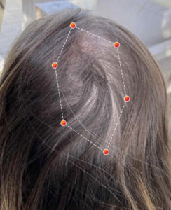 REVIAN RED Hair Growth System | The Right Light for Hair Growth