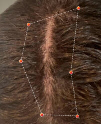 REVIAN RED Hair Growth System | The Right Light for Hair Growth