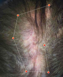 REVIAN RED Hair Growth System | The Right Light for Hair Growth